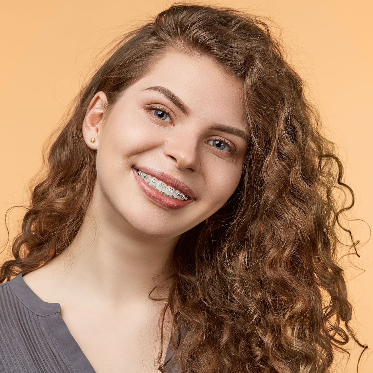 Metal Braces Santa Barbara, Traditional Braces Santa Barbara CA